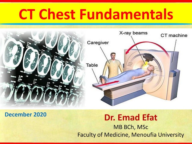 Ct chest fundamentals | PDF