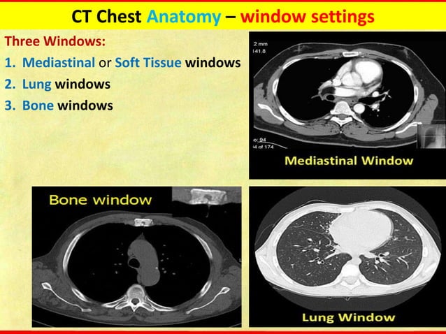 Ct chest fundamentals | PDF