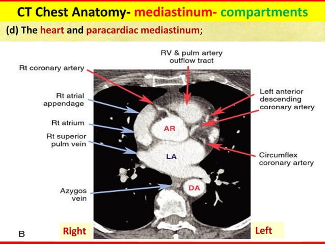 Ct chest fundamentals | PDF