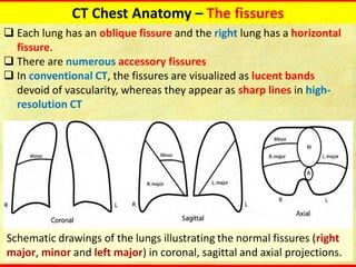 Ct chest fundamentals | PDF