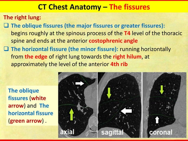 Ct chest fundamentals | PDF