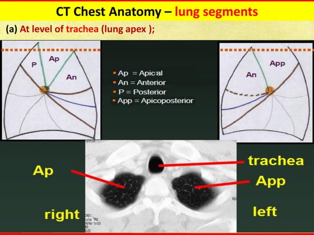 Ct chest fundamentals | PDF