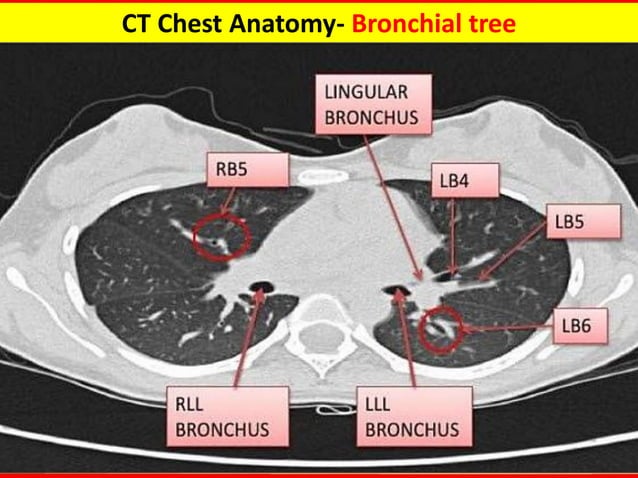 Ct chest fundamentals | PDF