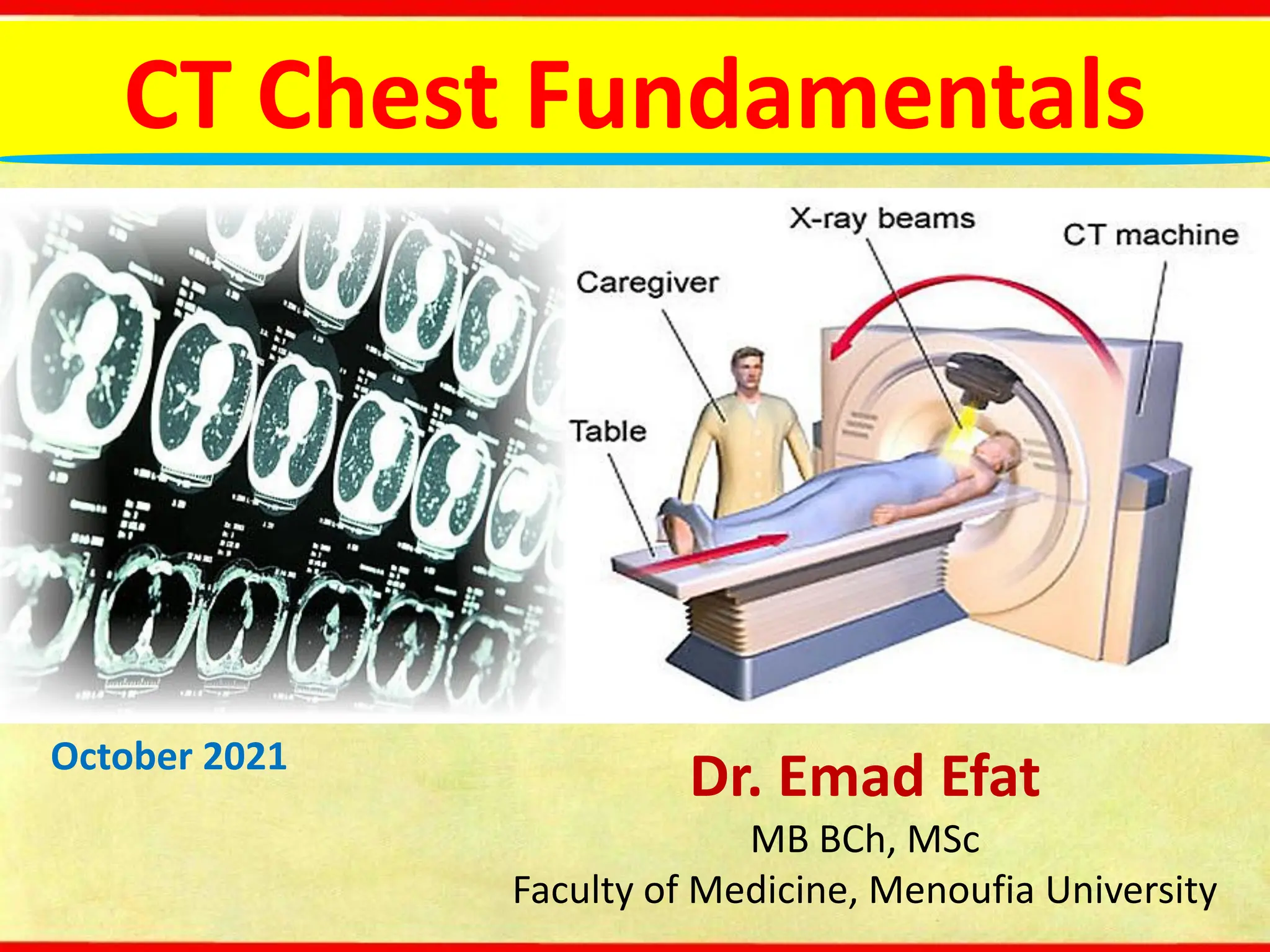 Computed tomography Chest Fundamentals update | PPT