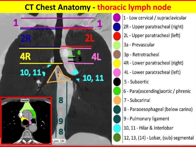 Computed tomography Chest Fundamentals update | PPT