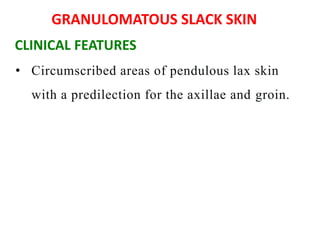 Cutaneous T Cell Lymphomas | PPTX