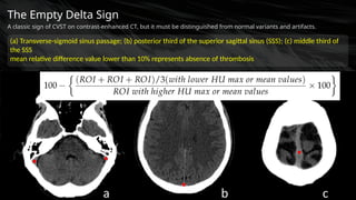 CT Clues to Cerebral Venous Sinus Thrombosis.pptx