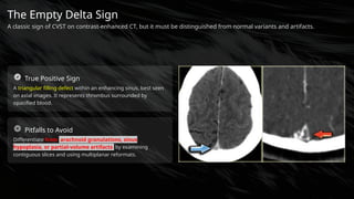 CT Clues to Cerebral Venous Sinus Thrombosis.pptx