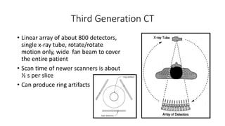 Ct computed tomography | PPT