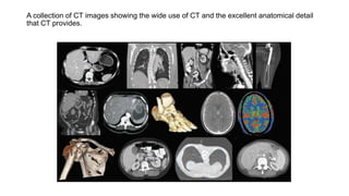 Ct computed tomography | PPT