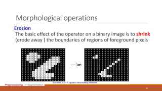 CT computer aided diagnosis system | PPTX