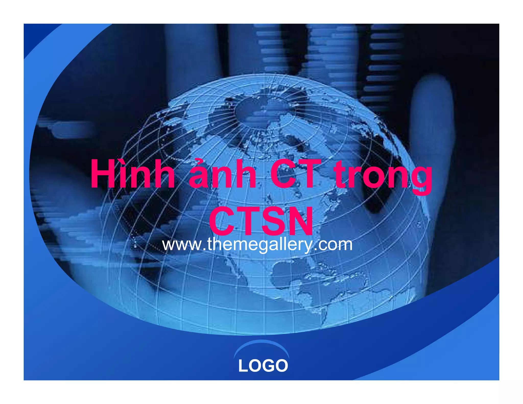 HÌNH ẢNH CT TRONG CHẤN THƯƠNG SỌ NÃO | PDF