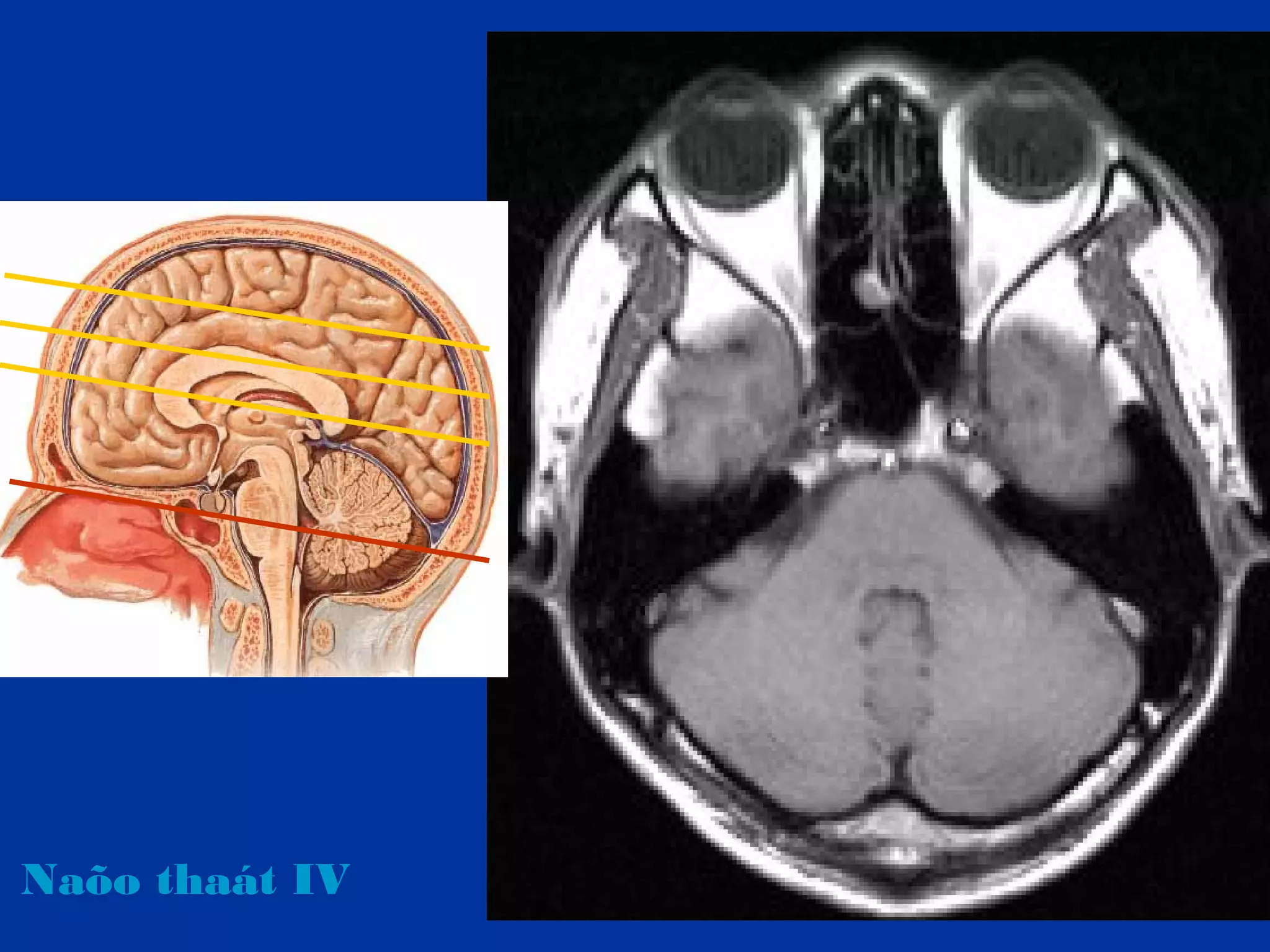 Ct ctsn #michelphuongcdha | PPT