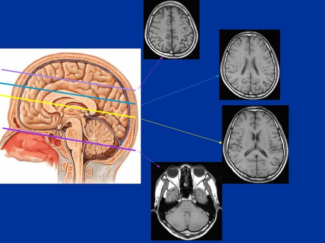 Ct ctsn #michelphuongcdha | PPT