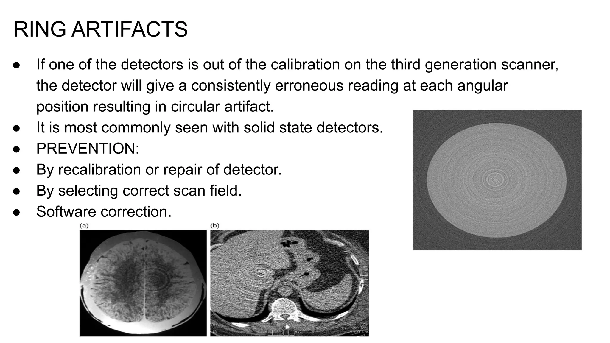 An overview of CT Detectors and Artefacts.pdf