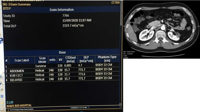 Computed Tomography Dose Index | PPTX