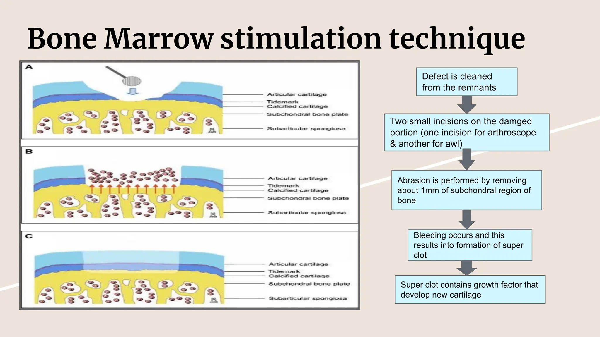 CTE ppt on CARTILAGE TISSUE ENGINEERING.pdf