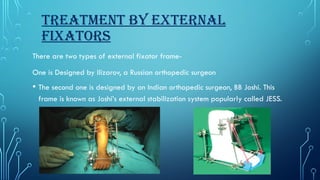 Club foot congenital disorders pediatrics | PPTX