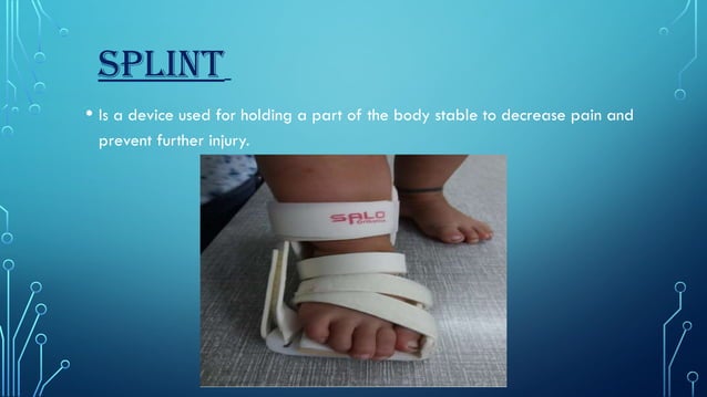 Club foot congenital disorders pediatrics | PPTX | Physical Therapy ...