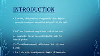 Club foot congenital disorders pediatrics | PPTX
