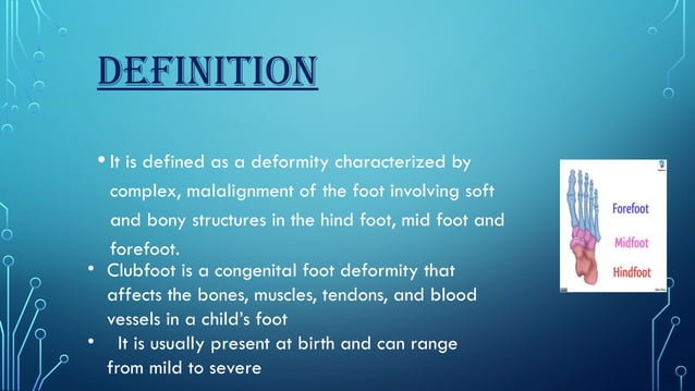 Club foot congenital disorders pediatrics | PPTX | Physical Therapy ...