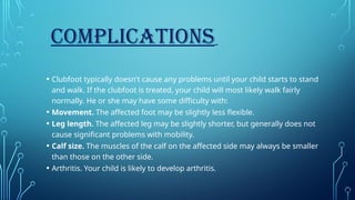 Club foot congenital disorders pediatrics | PPTX
