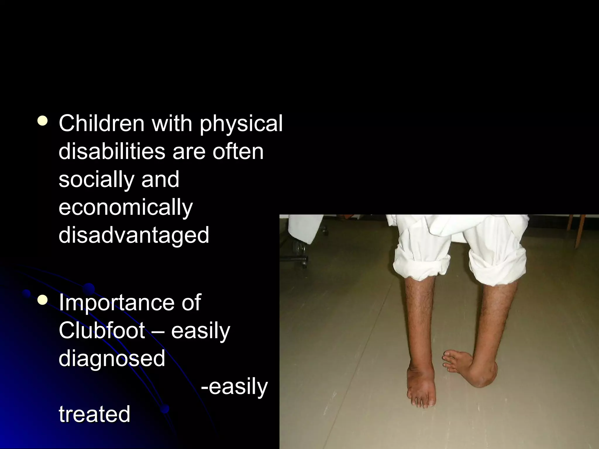 CONGENITAL TALIPES EQUINO VARUS | PPT