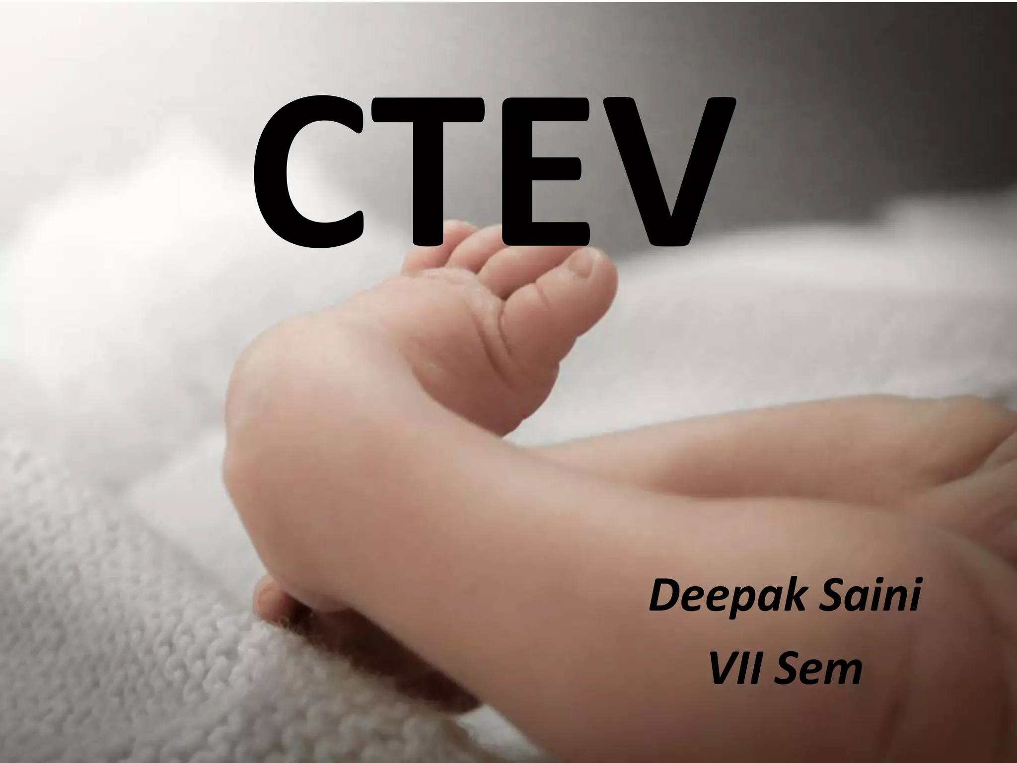 Congenital Talipes Equino Varus (CTEV) | PPTX | Foot Health | Diseases ...