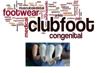 Congenital Talipes Equino Varus (CTEV) | PPT