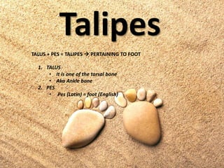 Congenital Talipes Equino Varus (CTEV) | PPTX | Foot Health | Diseases ...