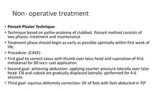 Congenital Talipes Equino Varus (CTEV) | PPTX