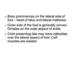 CTEV ( Congenital Talipes Equina Varus)- A short Review | PPT