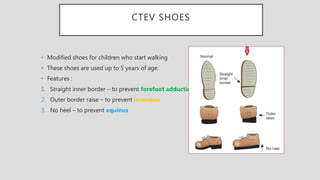 Ctev assessment & ponseti technique | PPT