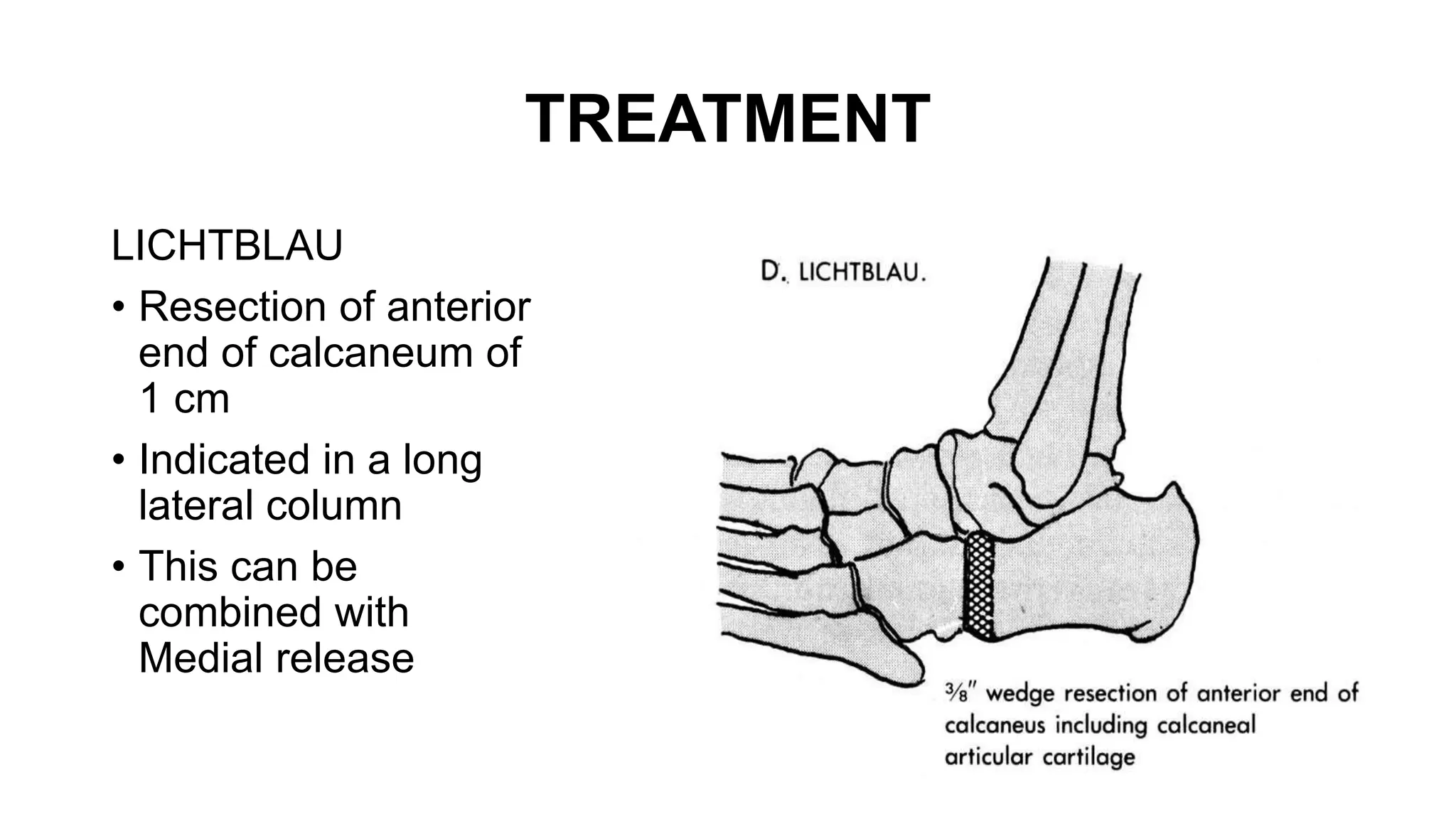 CTEV DEFORMITY.pptx