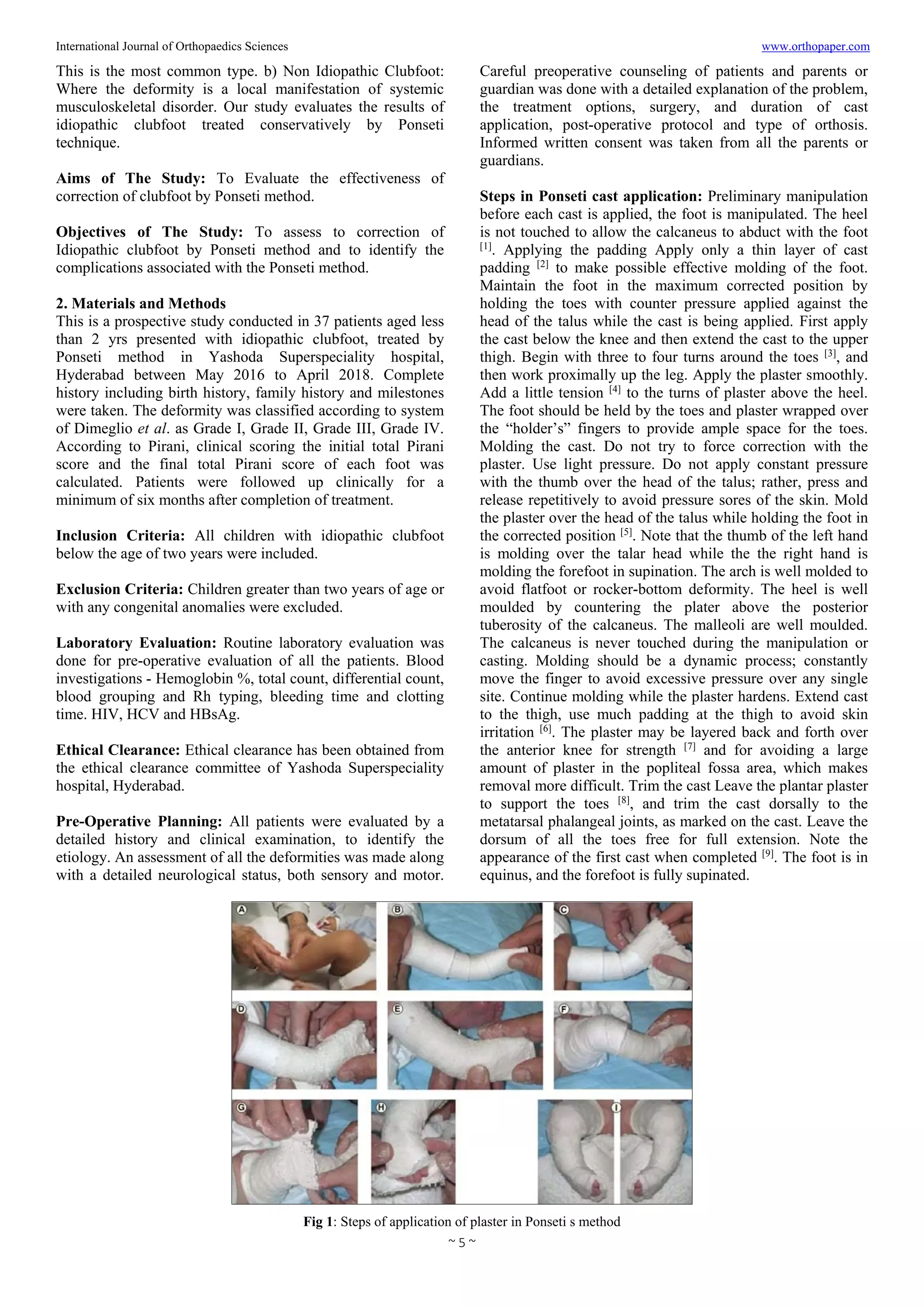 Correction of club foot by Ponseti method | PDF | Death, Injury, or ...