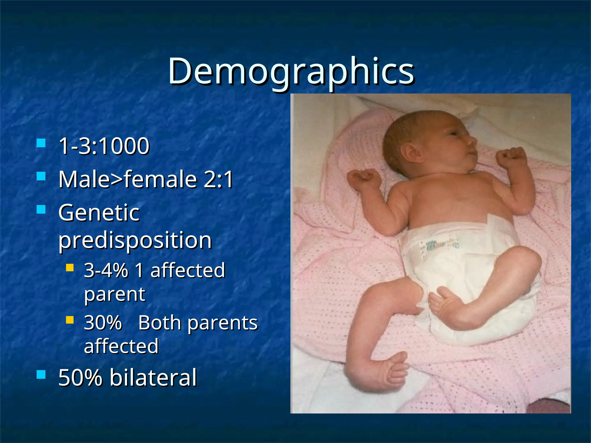 Congenital Talipes Equino Varus Deformity | PPT