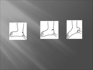 CTEV Pathoanatomy, Diagnosis, Conservative and Surgical Mx. | PPT