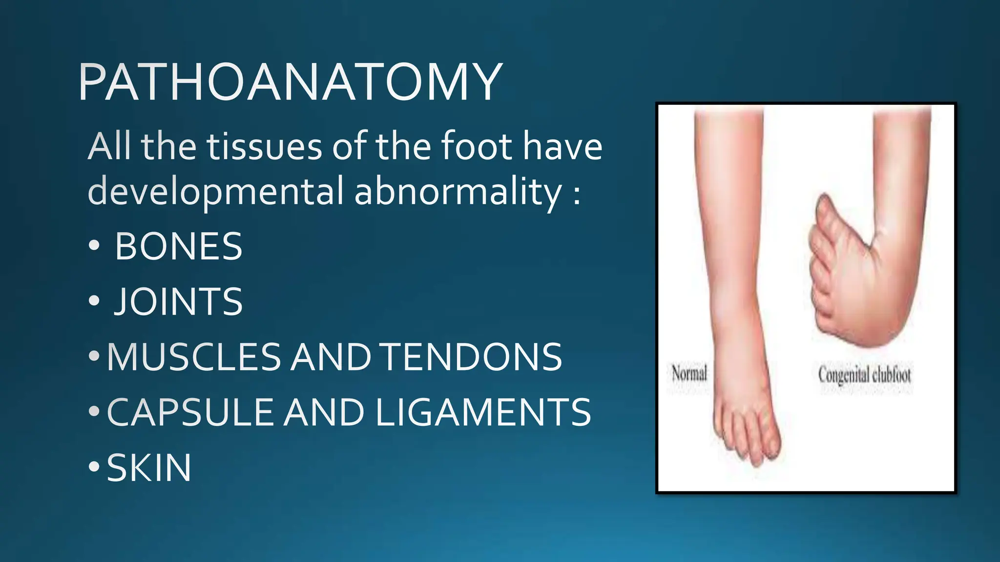 CTEV PATHOANATOMY.pptx