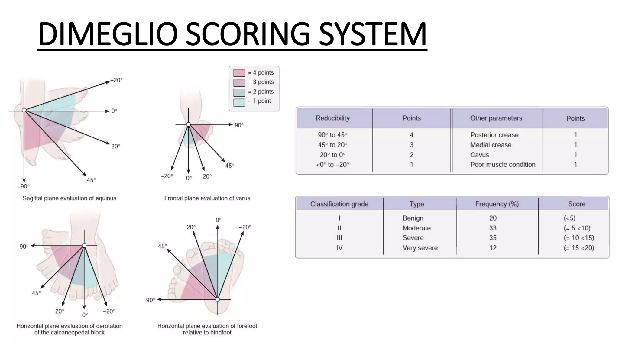Congenital talipes equinovarus (club foot/ctev) ppt by Dr Pratik | PPTX