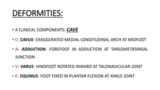 Congenital talipes equinovarus (club foot/ctev) ppt by Dr Pratik | PPTX