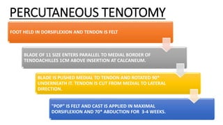 Congenital talipes equinovarus (club foot/ctev) ppt by Dr Pratik | PPTX