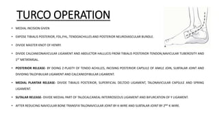 Congenital talipes equinovarus (club foot/ctev) ppt by Dr Pratik | PPTX