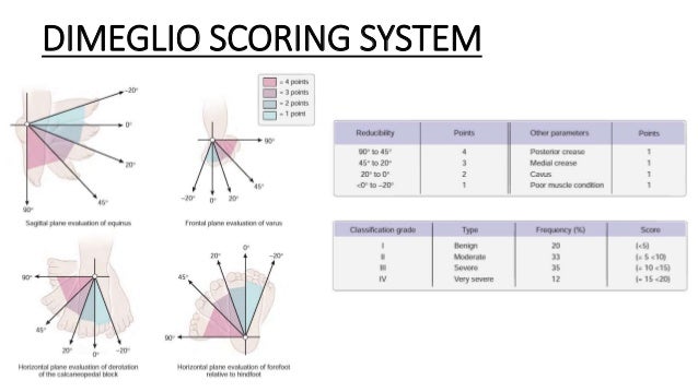Congenital talipes equinovarus (club foot/ctev) ppt by Dr Pratik