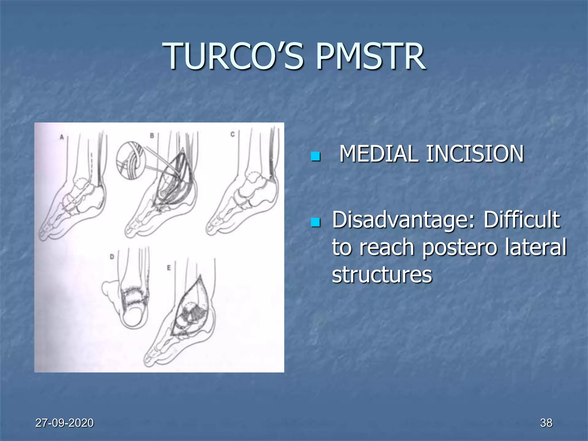 Ctev presentation | PPT