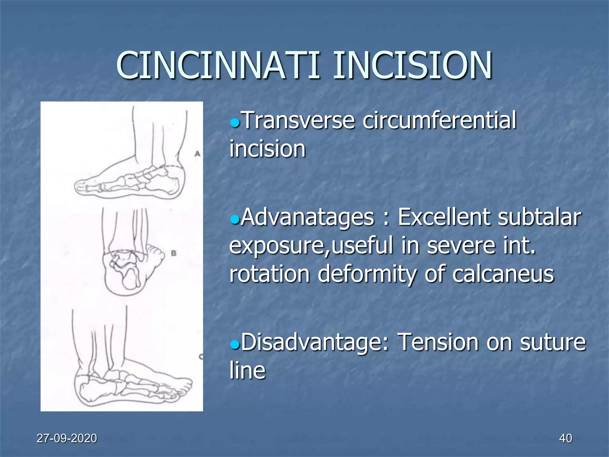 Ctev presentation | PPT