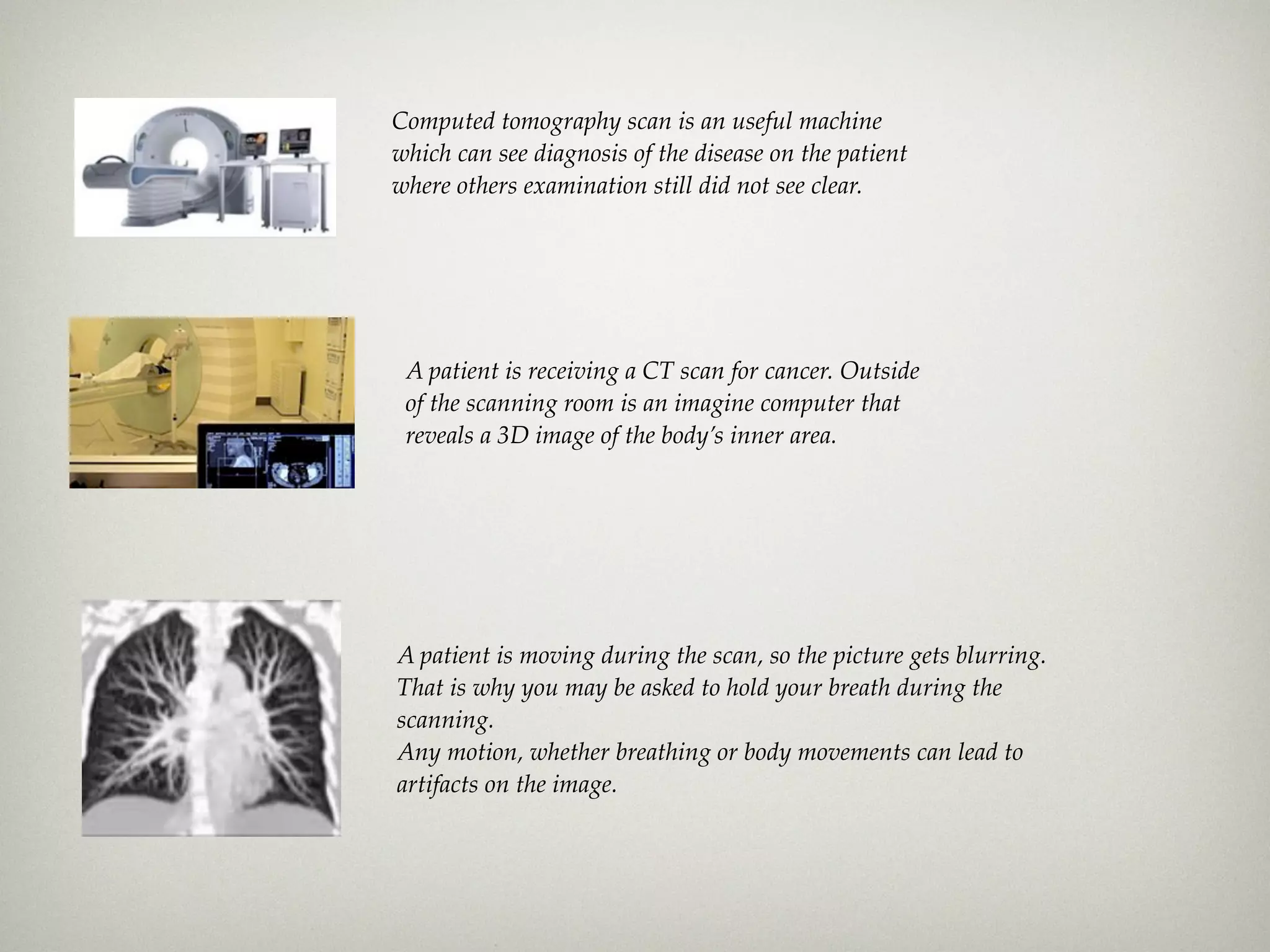Ct final pp presentation | KEY