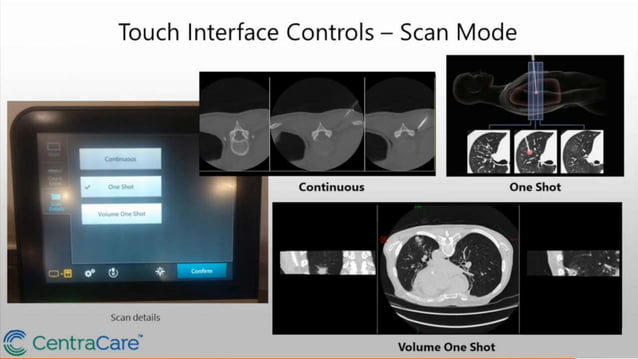CT fluoroscopy1 (1).pptx | Cameras and Camcorders | Consumer Electronics