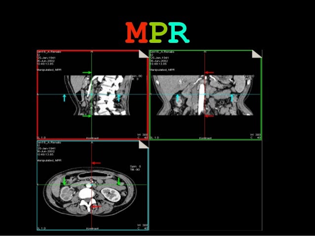 Basics of CT