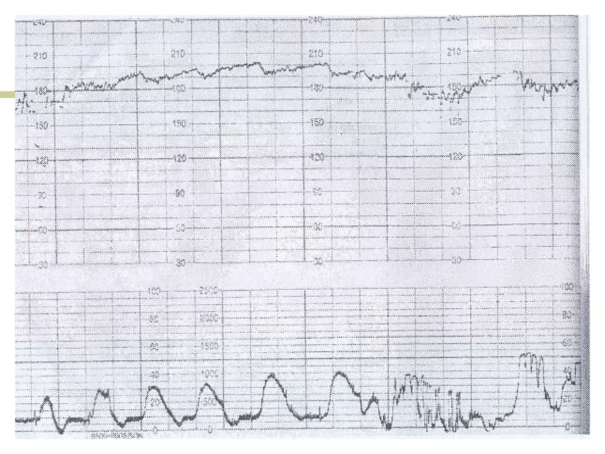 Cardiotocography (CTG) | PPT | Pregnancy | Reproductive Health