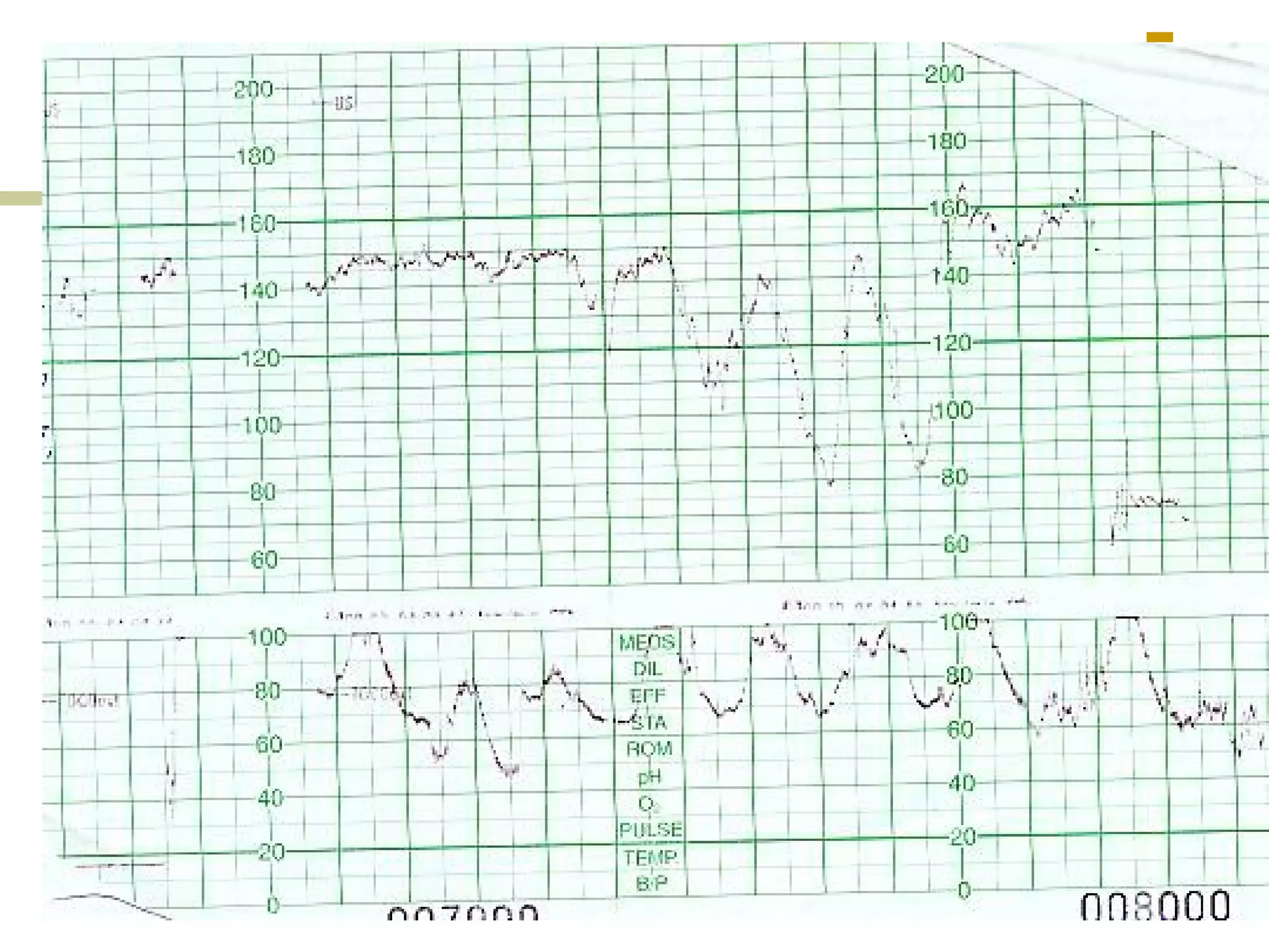 Cardiotocography (CTG) | PPT